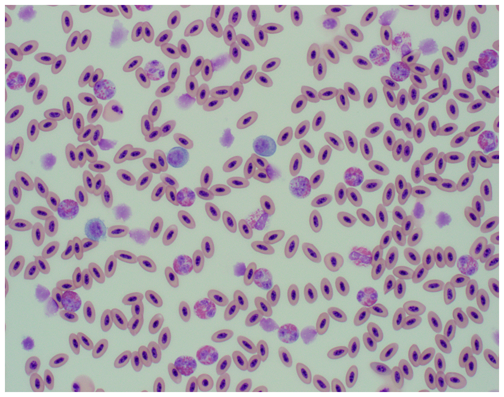 Hematology | Cellular Response to Disease - Clinical Avian Pathology ...