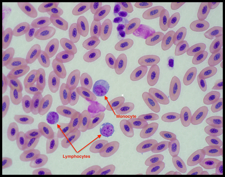 Hematology | Blood Cell Identification - Clinical Avian Pathology Services