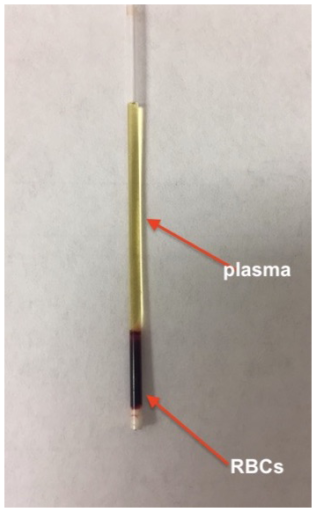 Hematology | Cellular Response to Disease - Clinical Avian Pathology ...